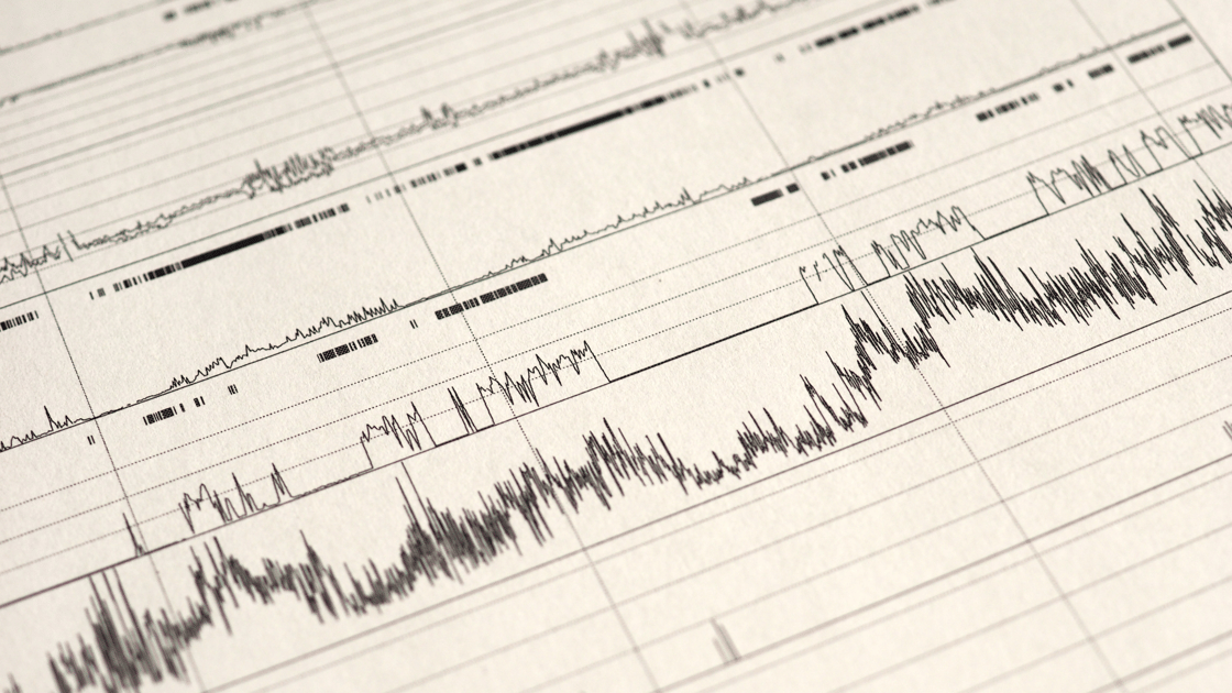Understanding Apnea-Hypopnea Index (AHI)