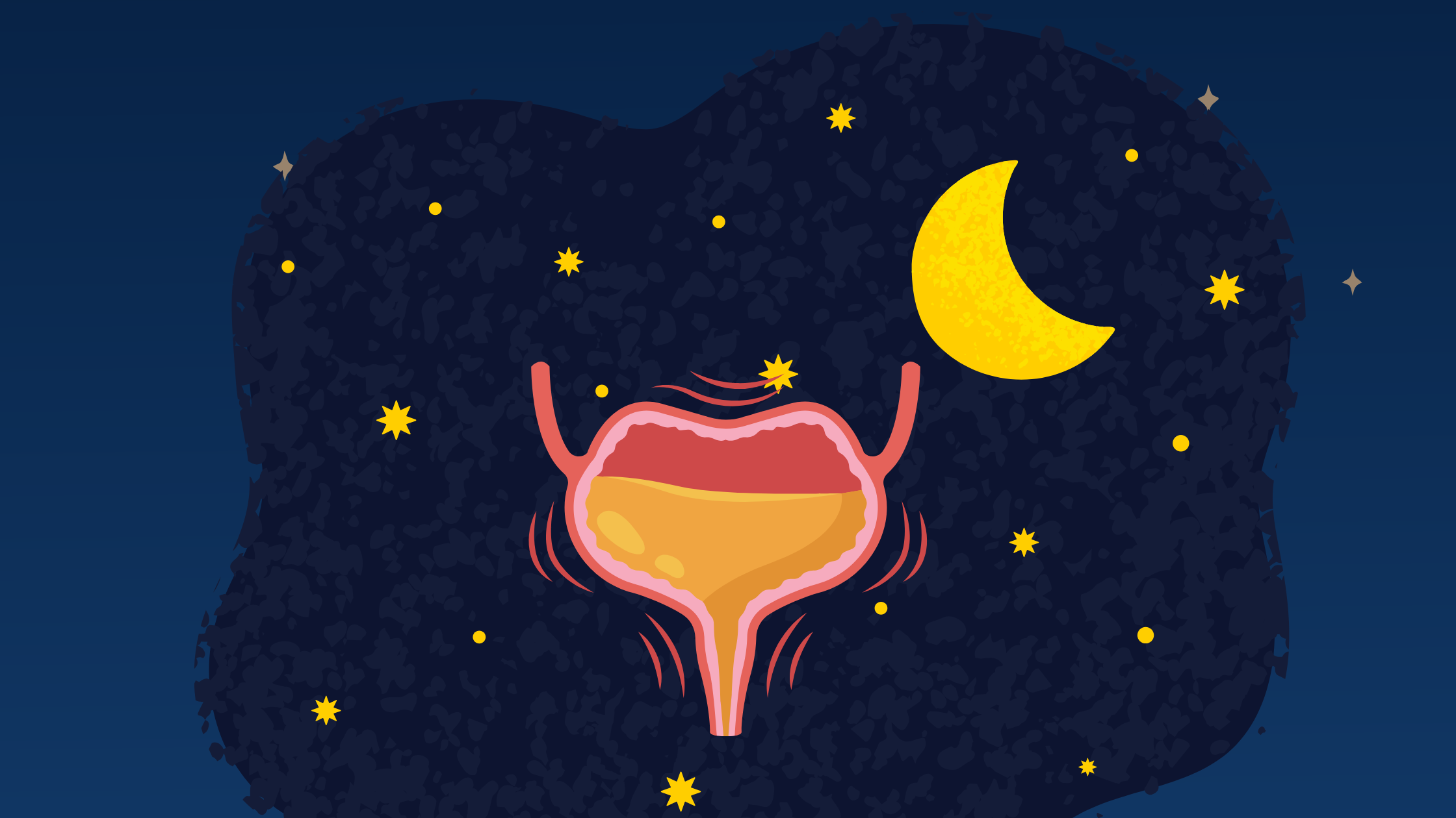 Overactive Bladder and Sleep: How Nighttime Urgency Impacts Rest