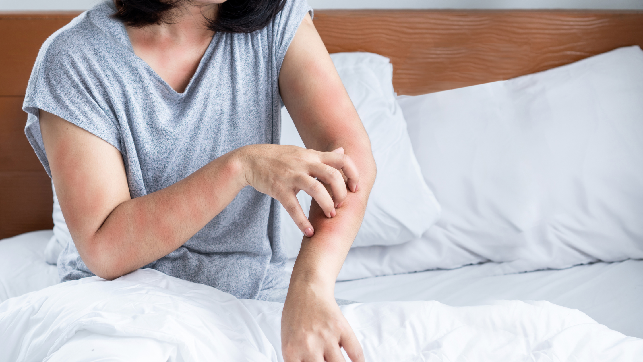 Why Am I So Itchy at Night? Common Causes of Nighttime Itching