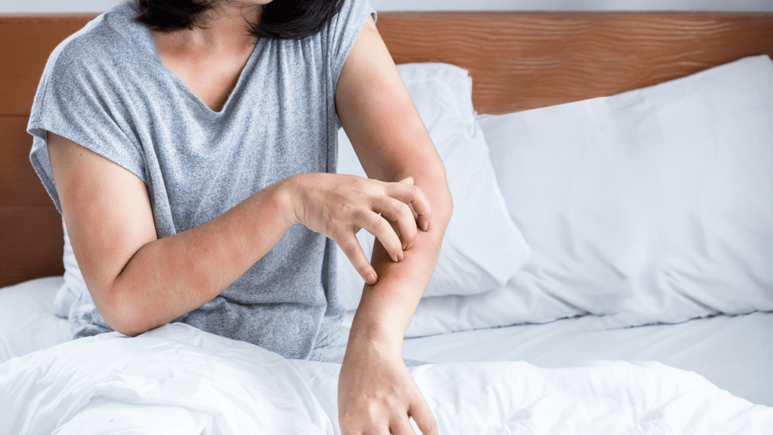 Why Am I So Itchy at Night? Common Causes of Nighttime Itching